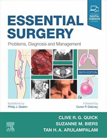 Essential Surgery : Problems, Diagnosis and Management, 6th Edition