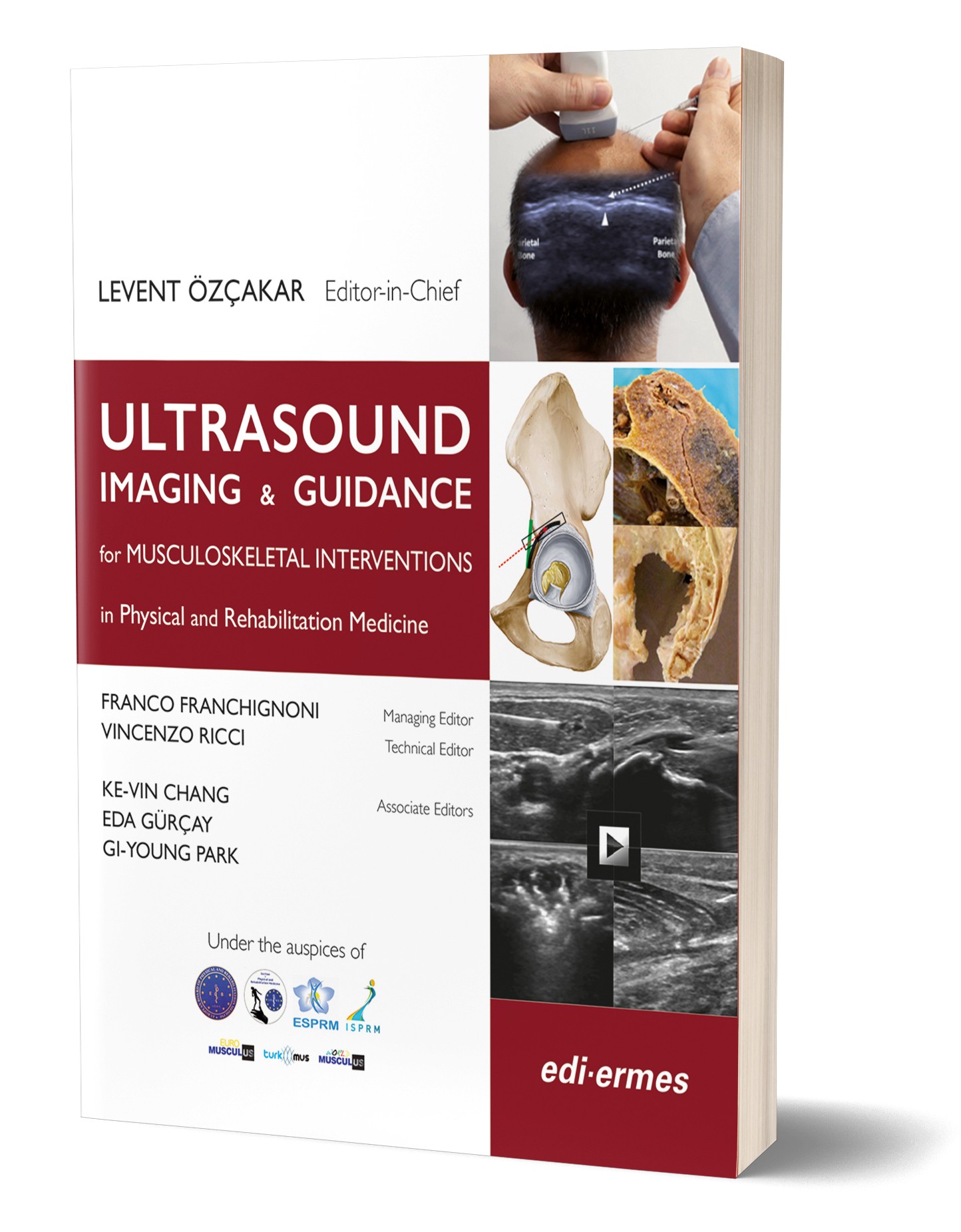ULTRASOUND IMAGING & GUIDANCE FOR MUSCULOSKELETAL INTERVENTIONS IN ...