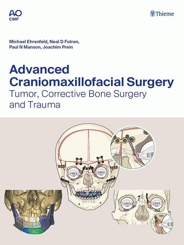 Advanced Craniomaxillofacial Surgery
