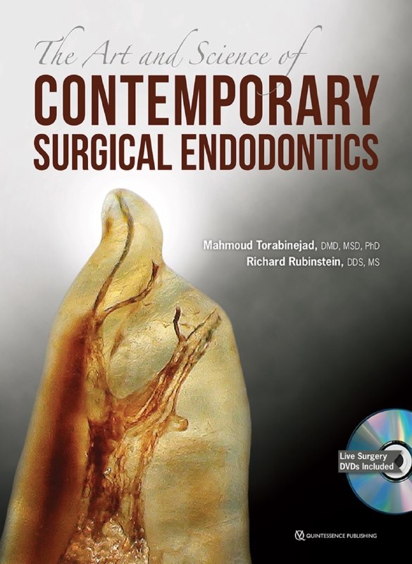 The Art and Science of Contemporary Surgical Endodontics